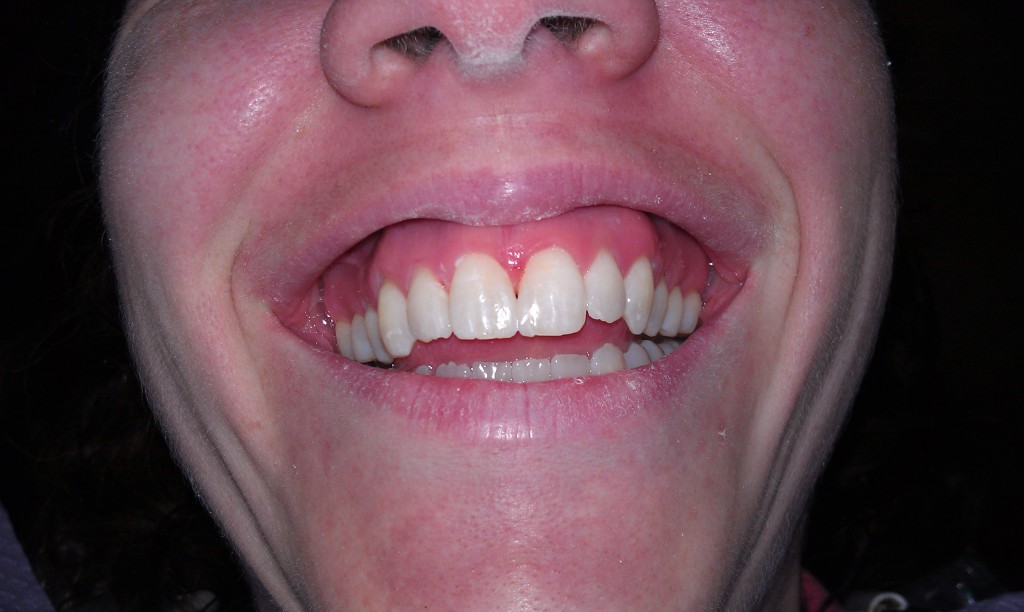 Holladay UT Testimonials | Daniel Poulson DDS | Daniel S. Poulson